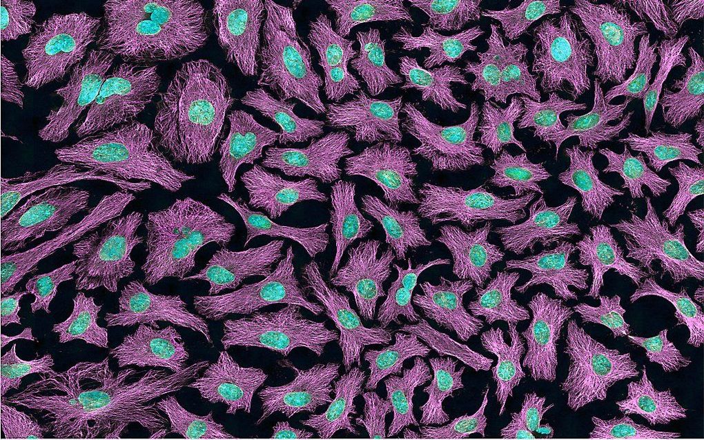 „Duizenden wetenschappelijke artikelen gebaseerd op verkeerde cellen”
