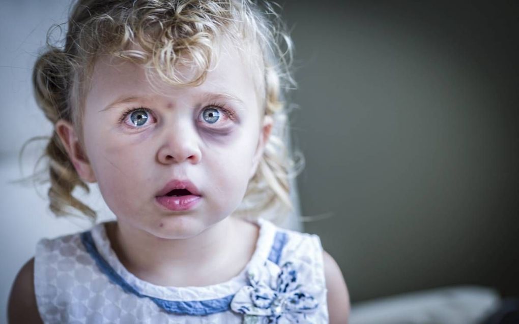 Betere opsporing mishandeling door controle bloot kind