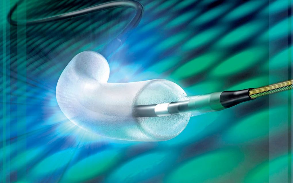 Dotteren met medicijnballon