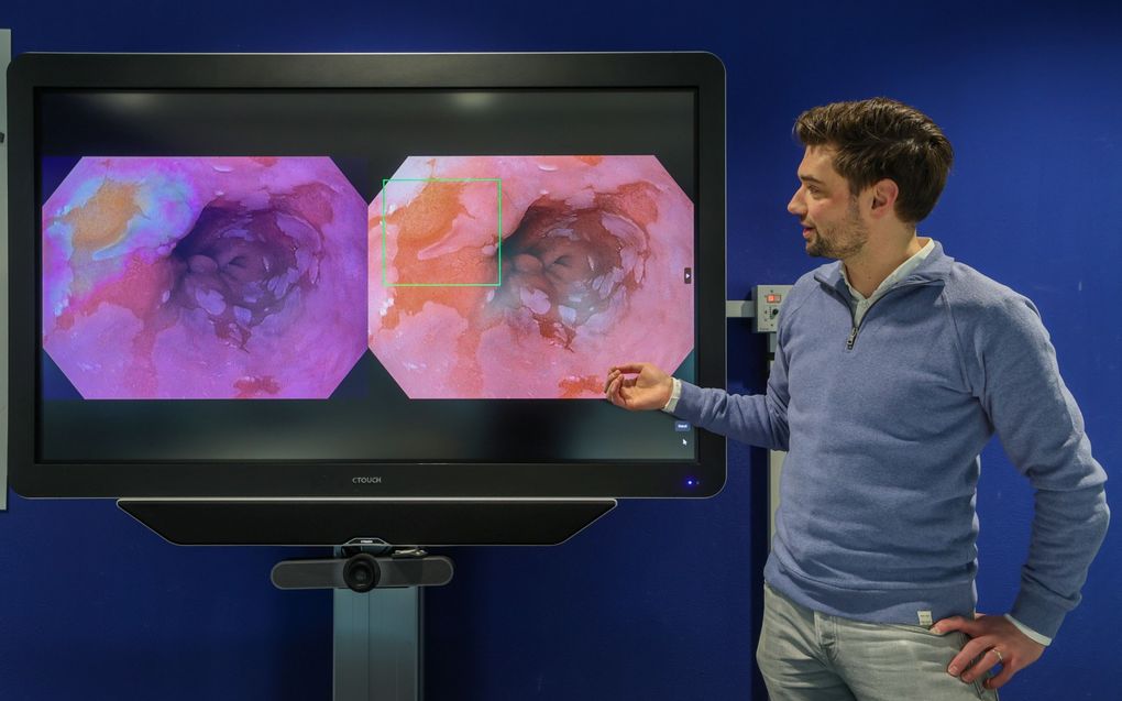 Slim algoritme herkent kanker bij patiënt met Barrett-slokdarm